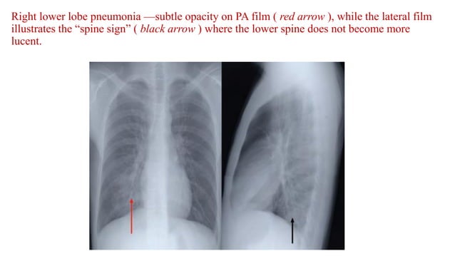 Atlas of chest imaging | PDF