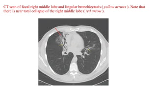 Atlas of chest imaging | PDF
