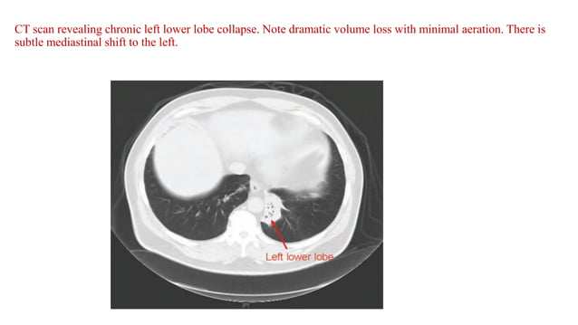 Atlas of chest imaging | PDF