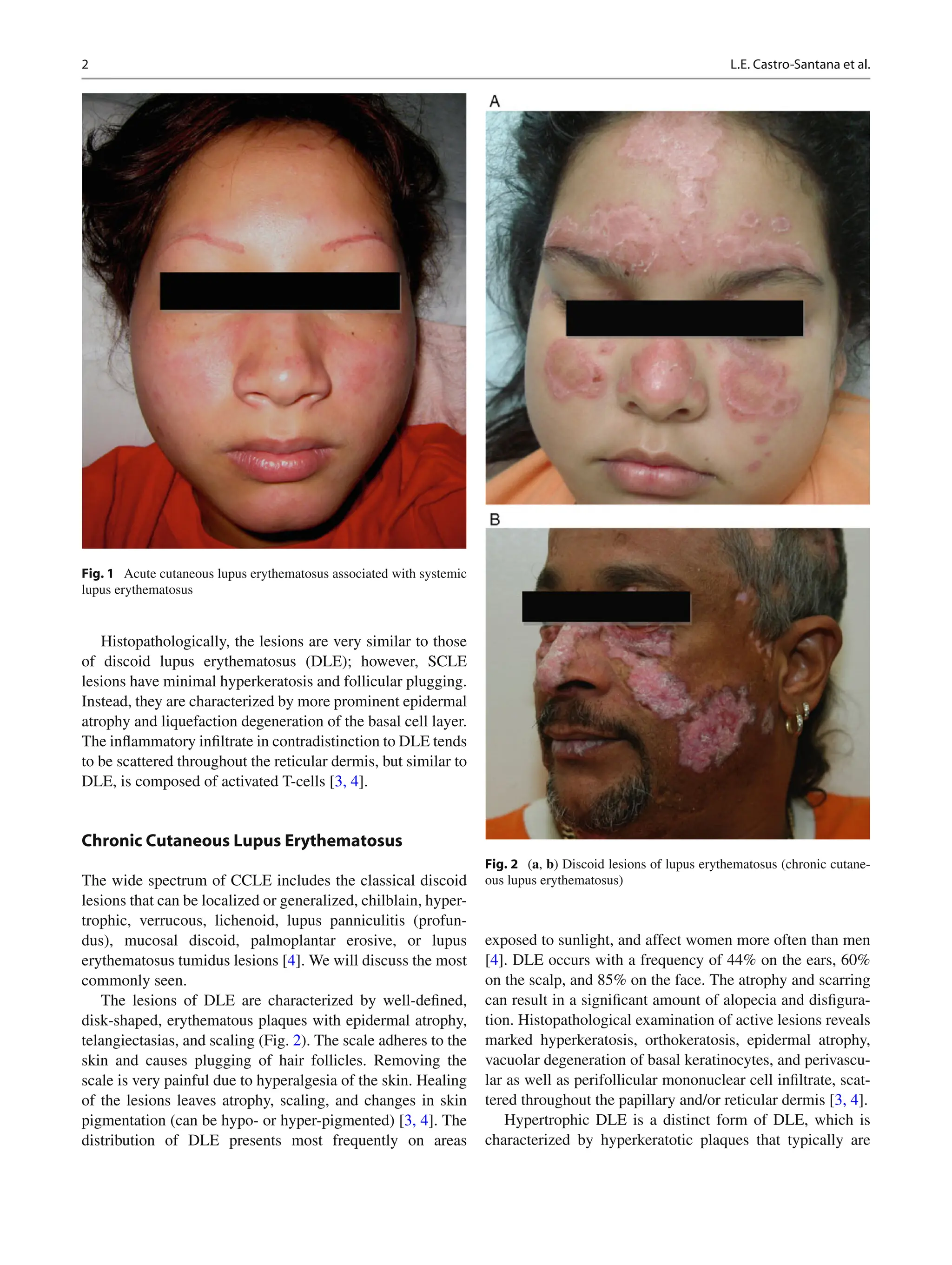 Atlas of Dermatology in Internal Medicine. 2012.pdf