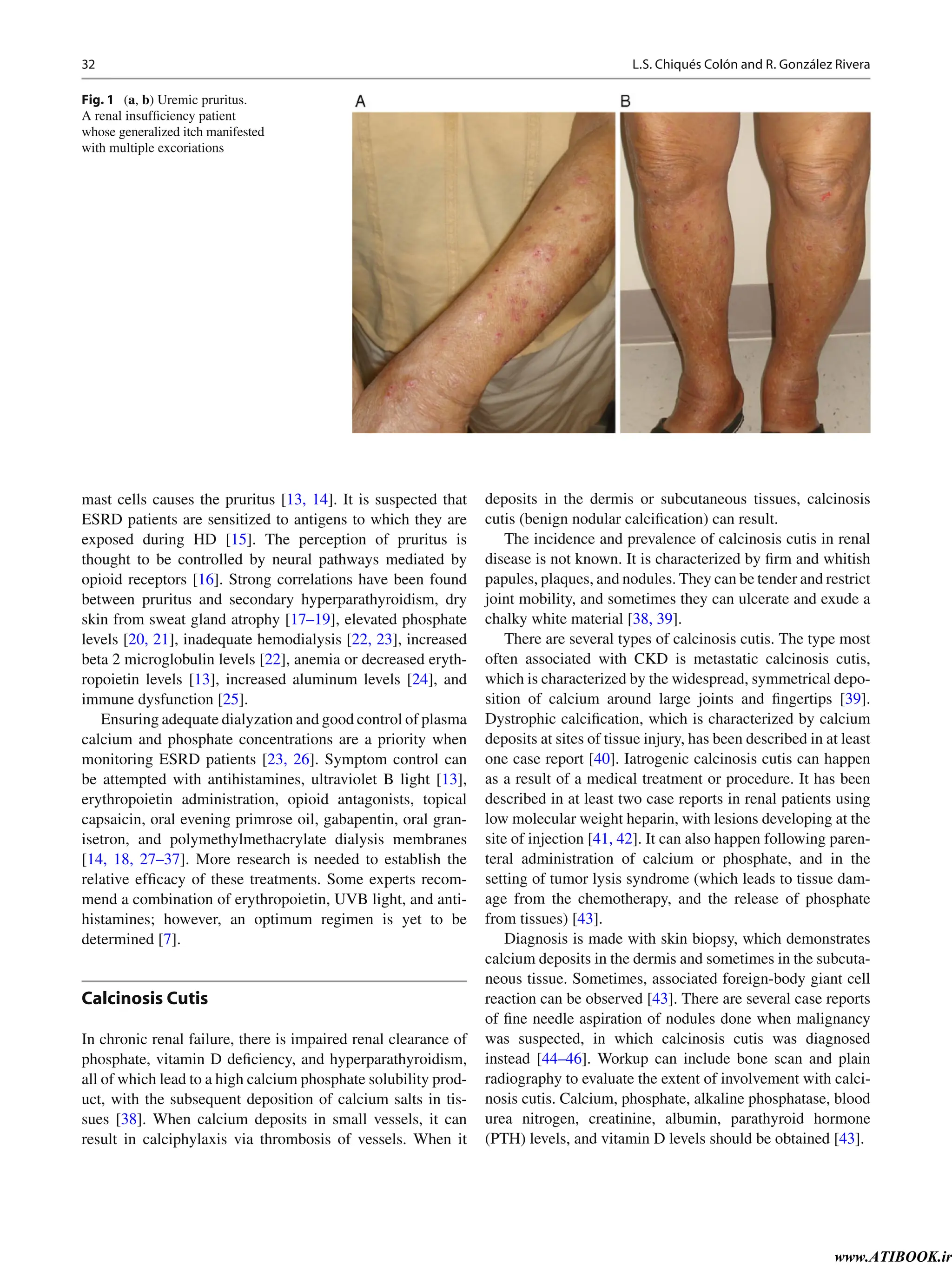 Atlas of Dermatology in Internal Medicine. 2012.pdf
