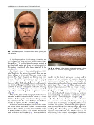 Atlas of Dermatology in Internal Medicine. 2012.pdf