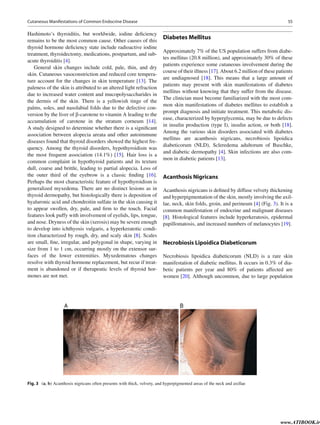Atlas of Dermatology in Internal Medicine. 2012.pdf