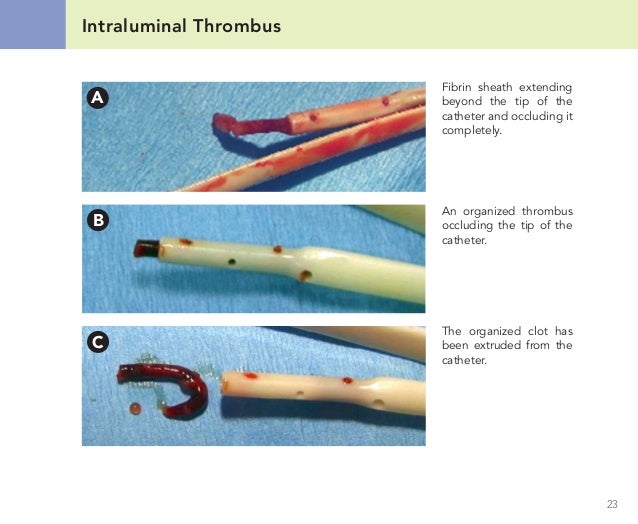 Atlas of dialysis vascular access