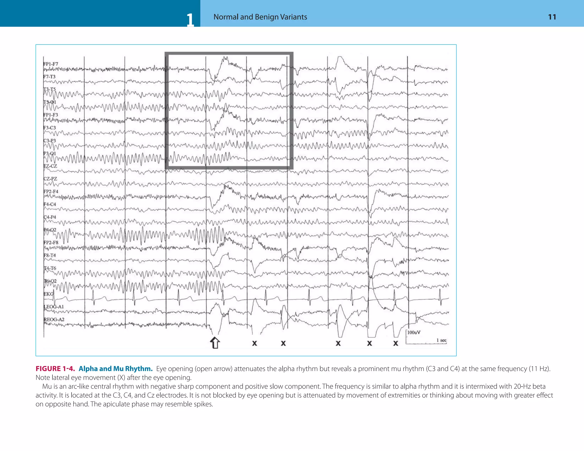ATLAS OF EEG.pdf