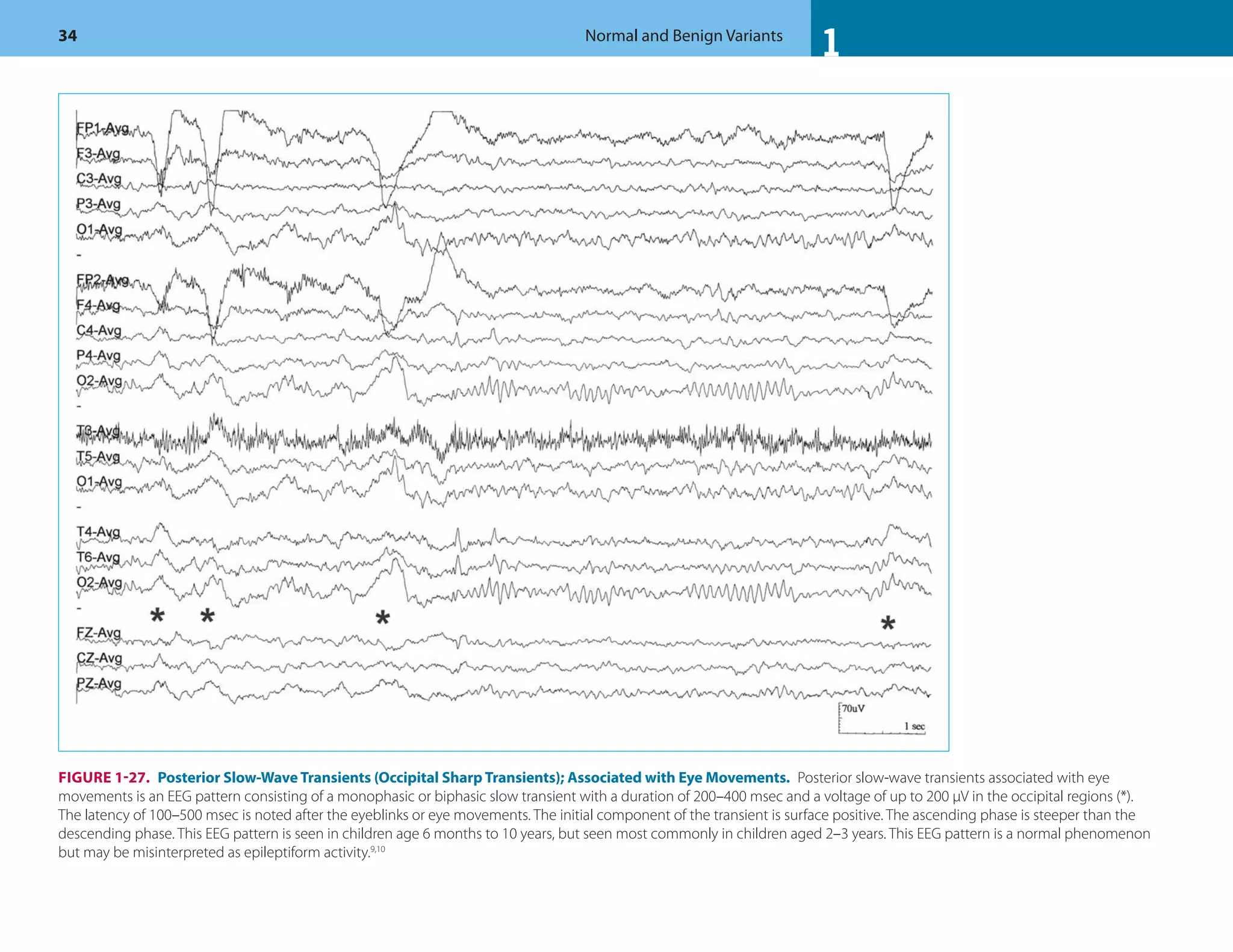 ATLAS OF EEG.pdf