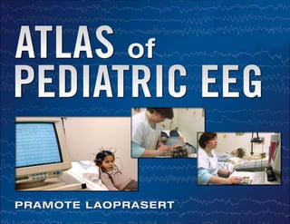 ATLAS OF EEG.pdf