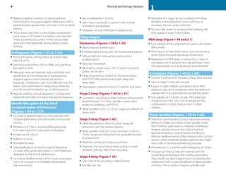ATLAS OF EEG.pdf