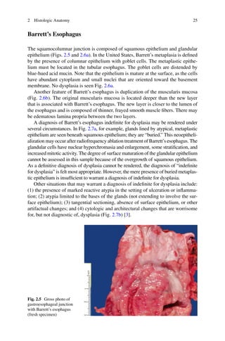 Atlas of esophageal disease and intervention | PDF