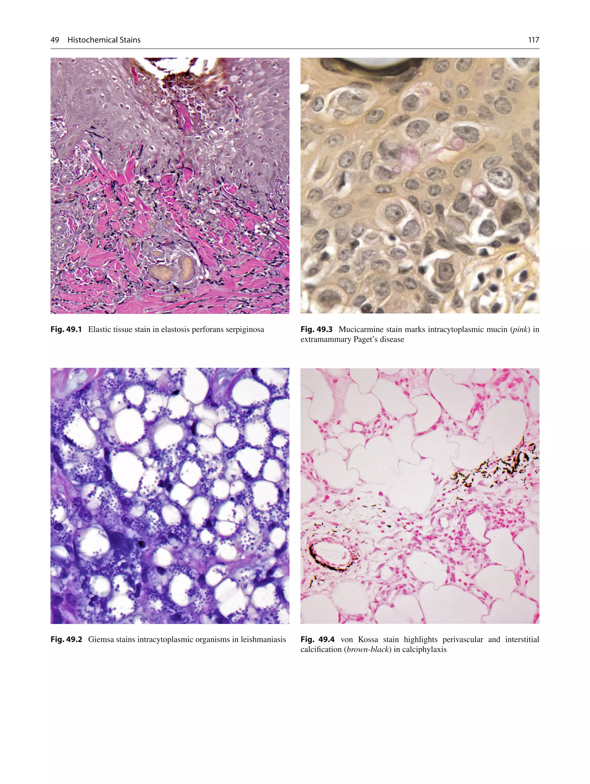 Atlas of essential dermatopathology | PDF