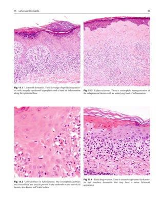 Atlas of essential dermatopathology | PDF