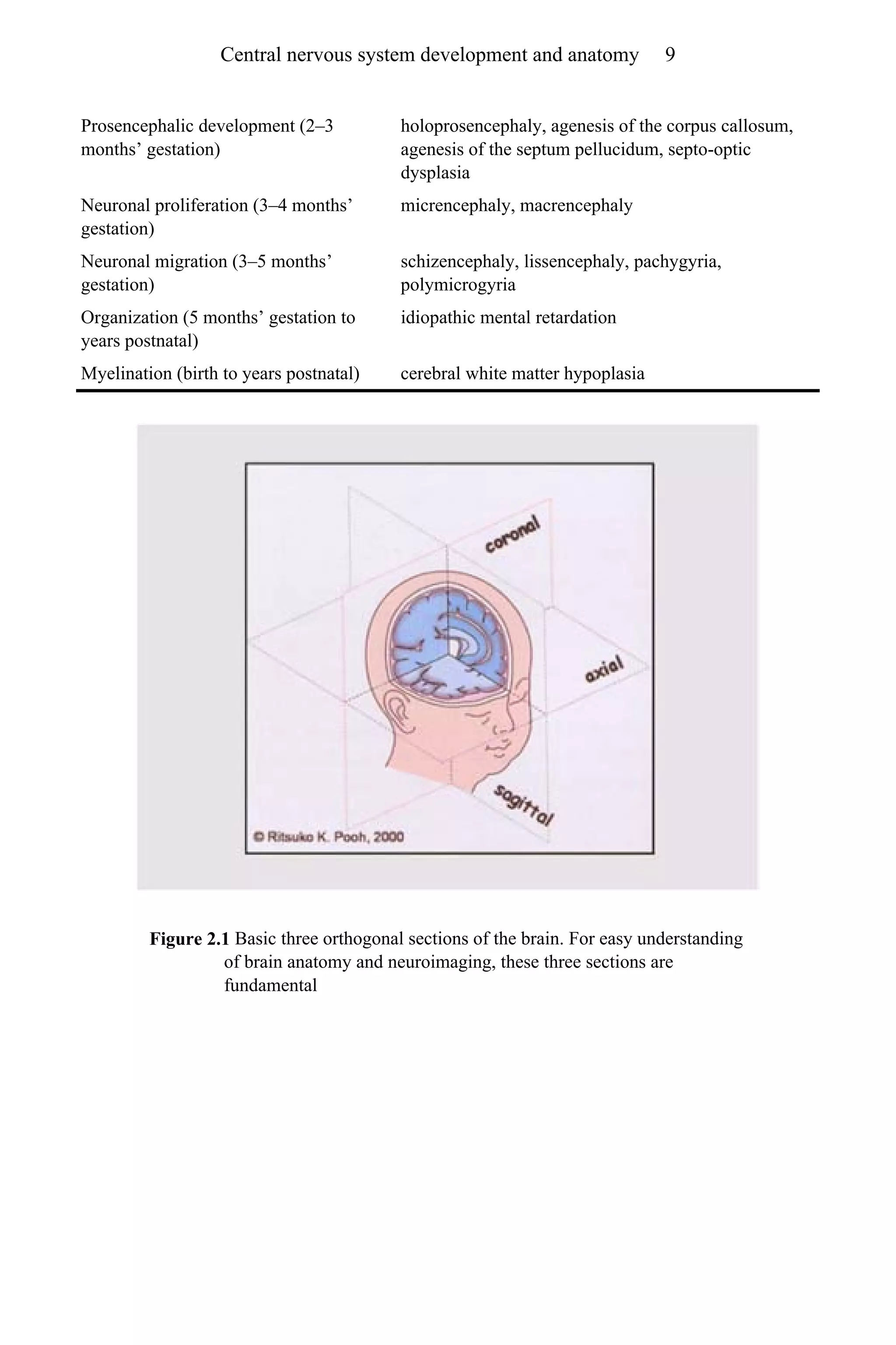 ATLAS OF FETAL CENTRAL NERVOUS SYSTEM DISEASE.pdf
