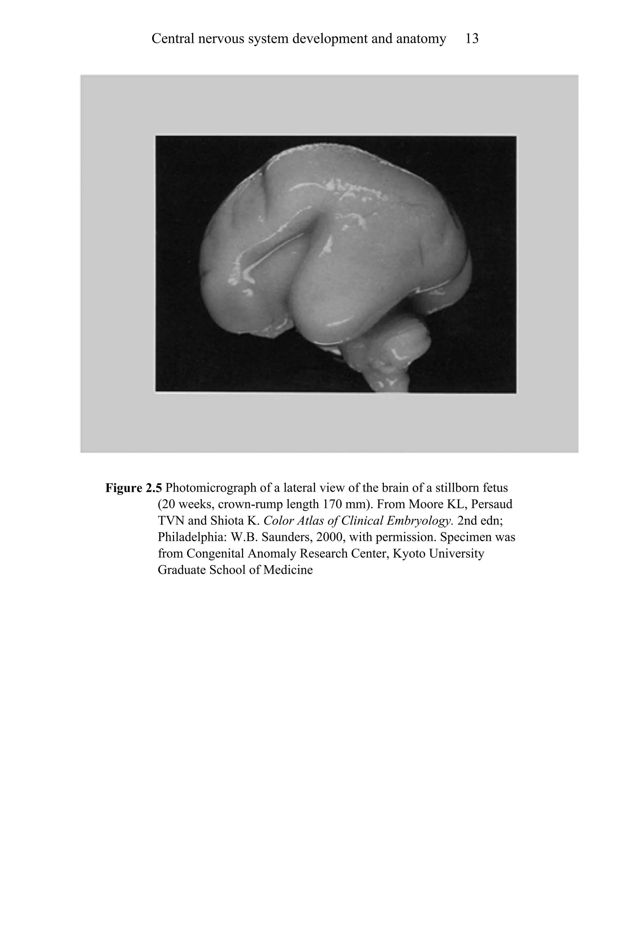 ATLAS OF FETAL CENTRAL NERVOUS SYSTEM DISEASE.pdf