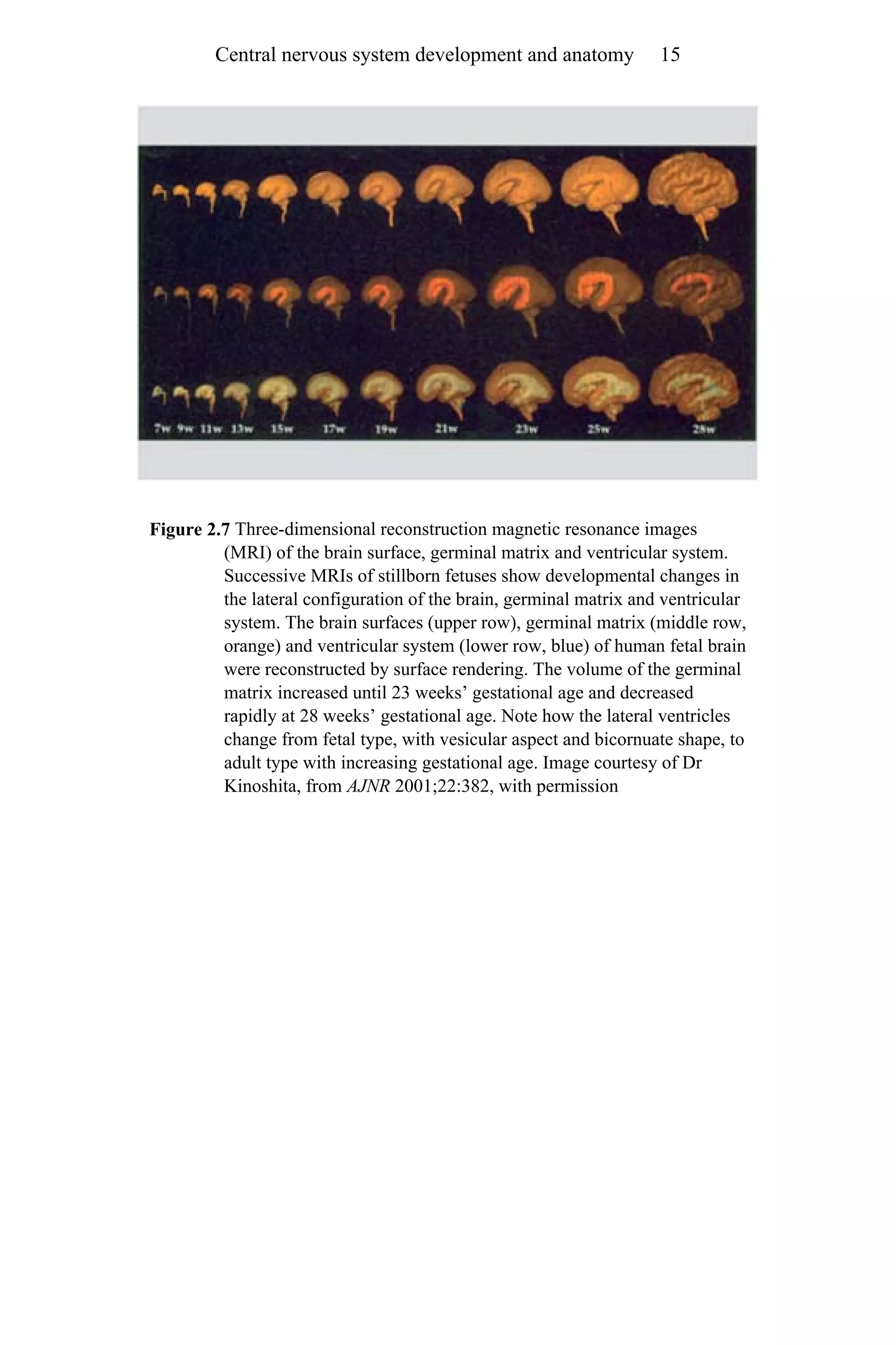 ATLAS OF FETAL CENTRAL NERVOUS SYSTEM DISEASE.pdf