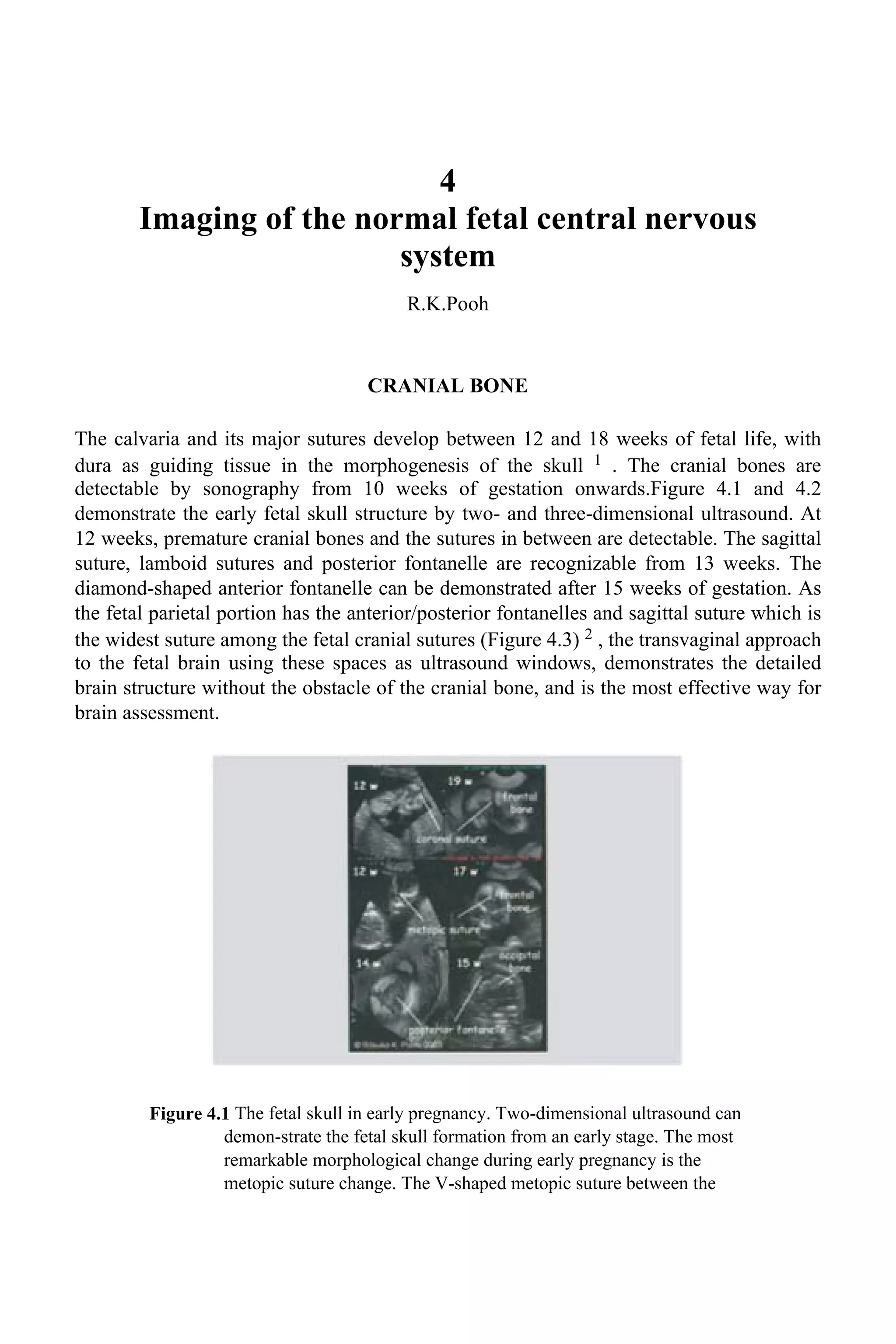 ATLAS OF FETAL CENTRAL NERVOUS SYSTEM DISEASE.pdf