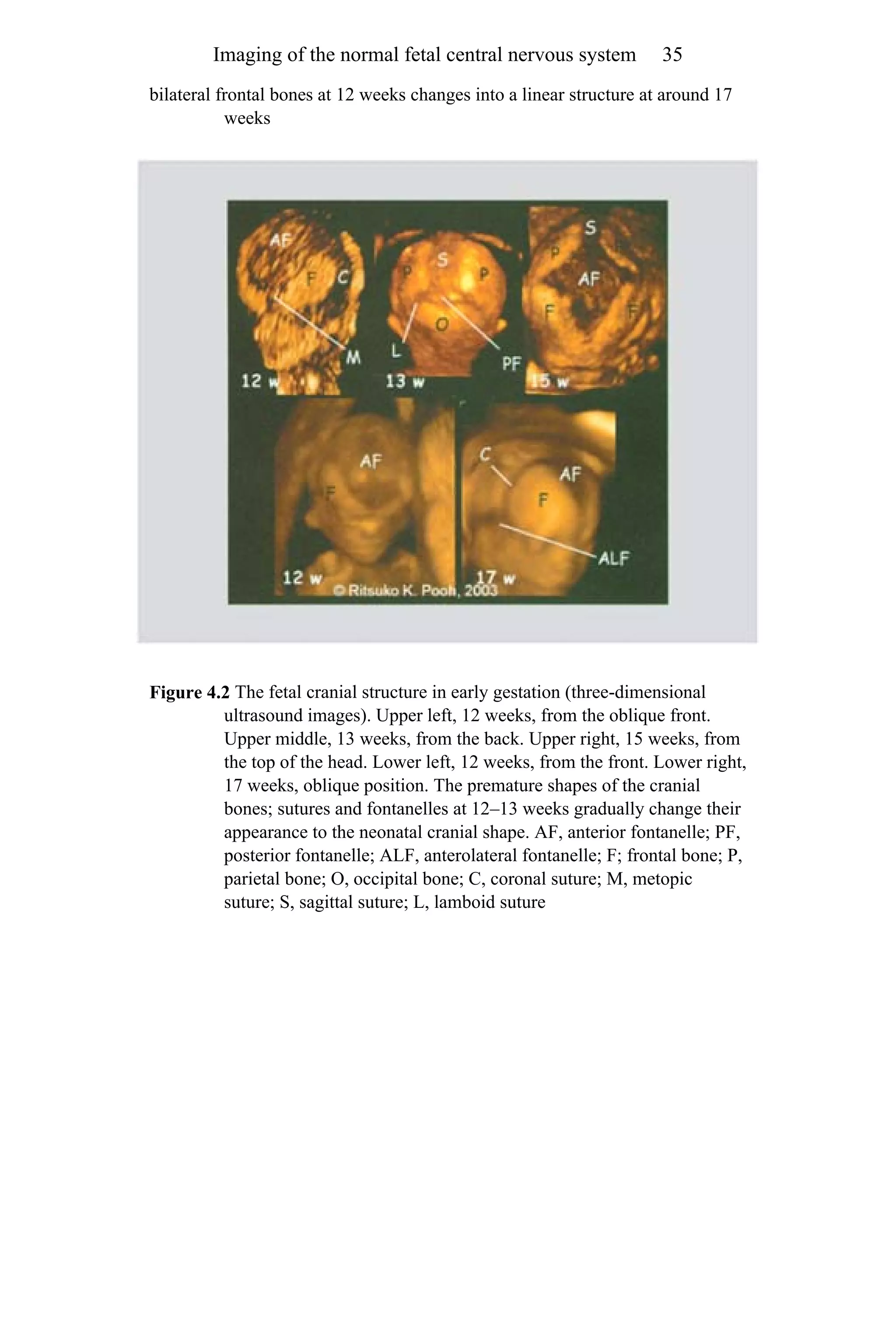 ATLAS OF FETAL CENTRAL NERVOUS SYSTEM DISEASE.pdf