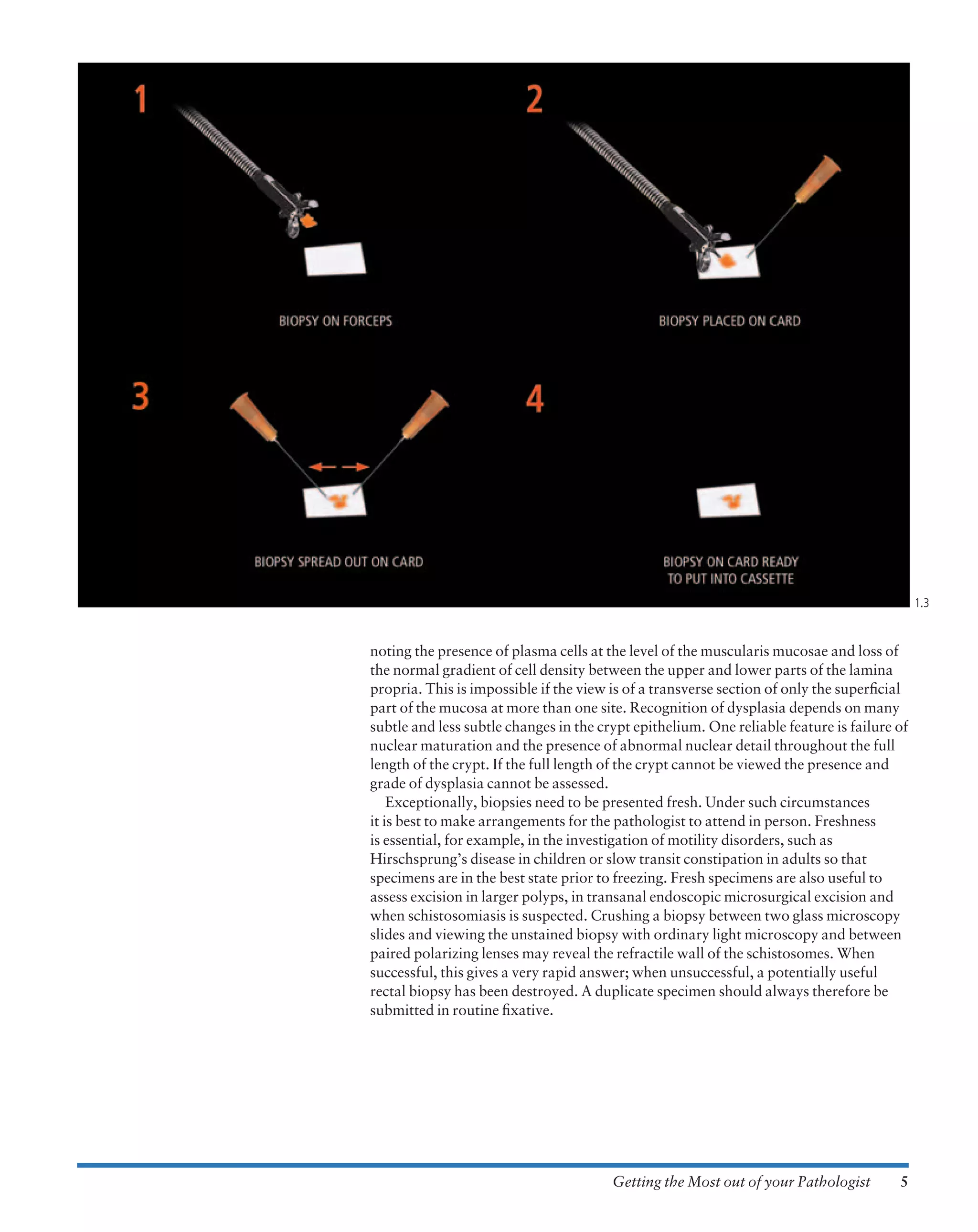 Atlas of gastrointestinal endoscopy and related pathology (blackwell ...