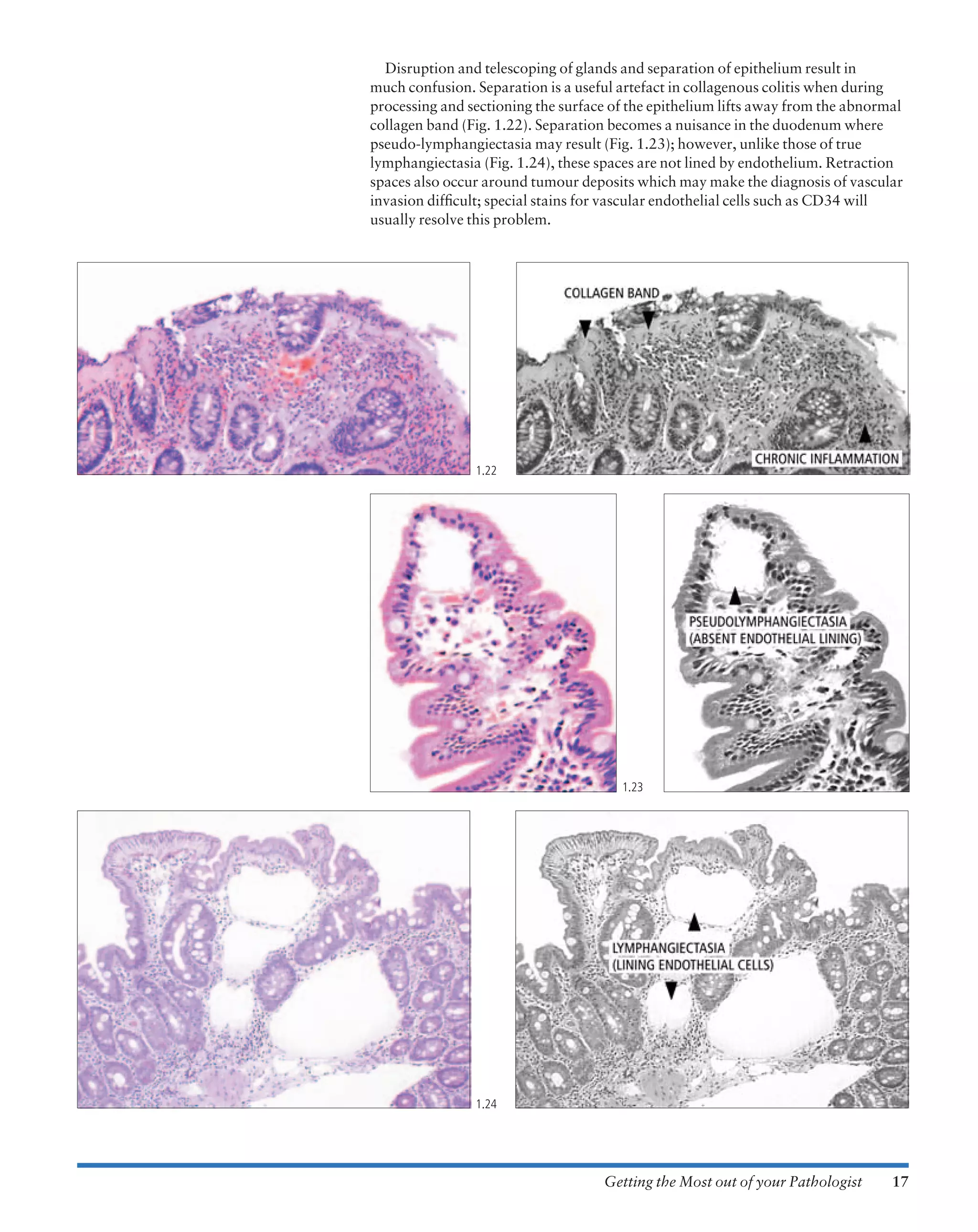Atlas of gastrointestinal endoscopy and related pathology (blackwell ...