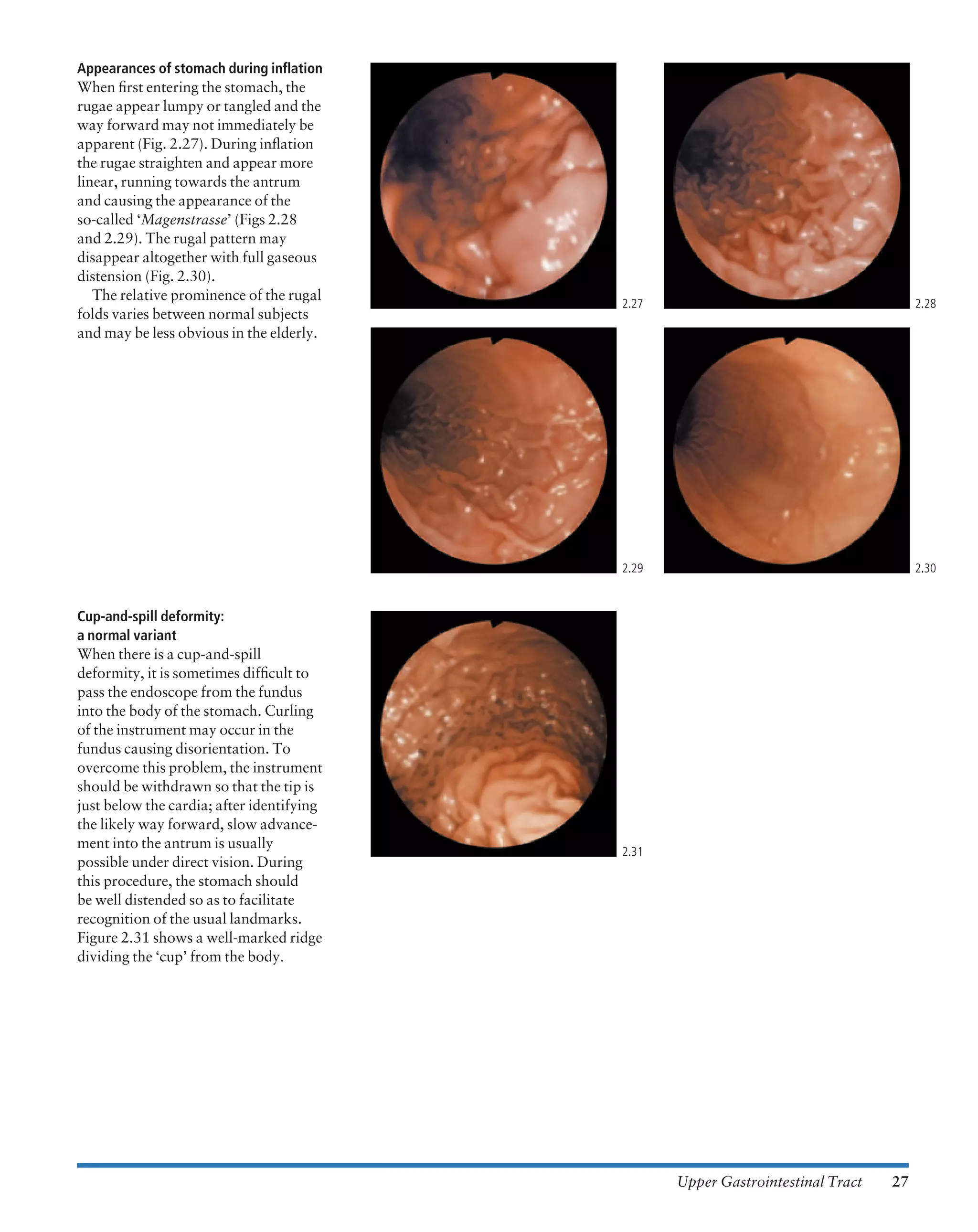 Atlas of gastrointestinal endoscopy and related pathology (blackwell ...