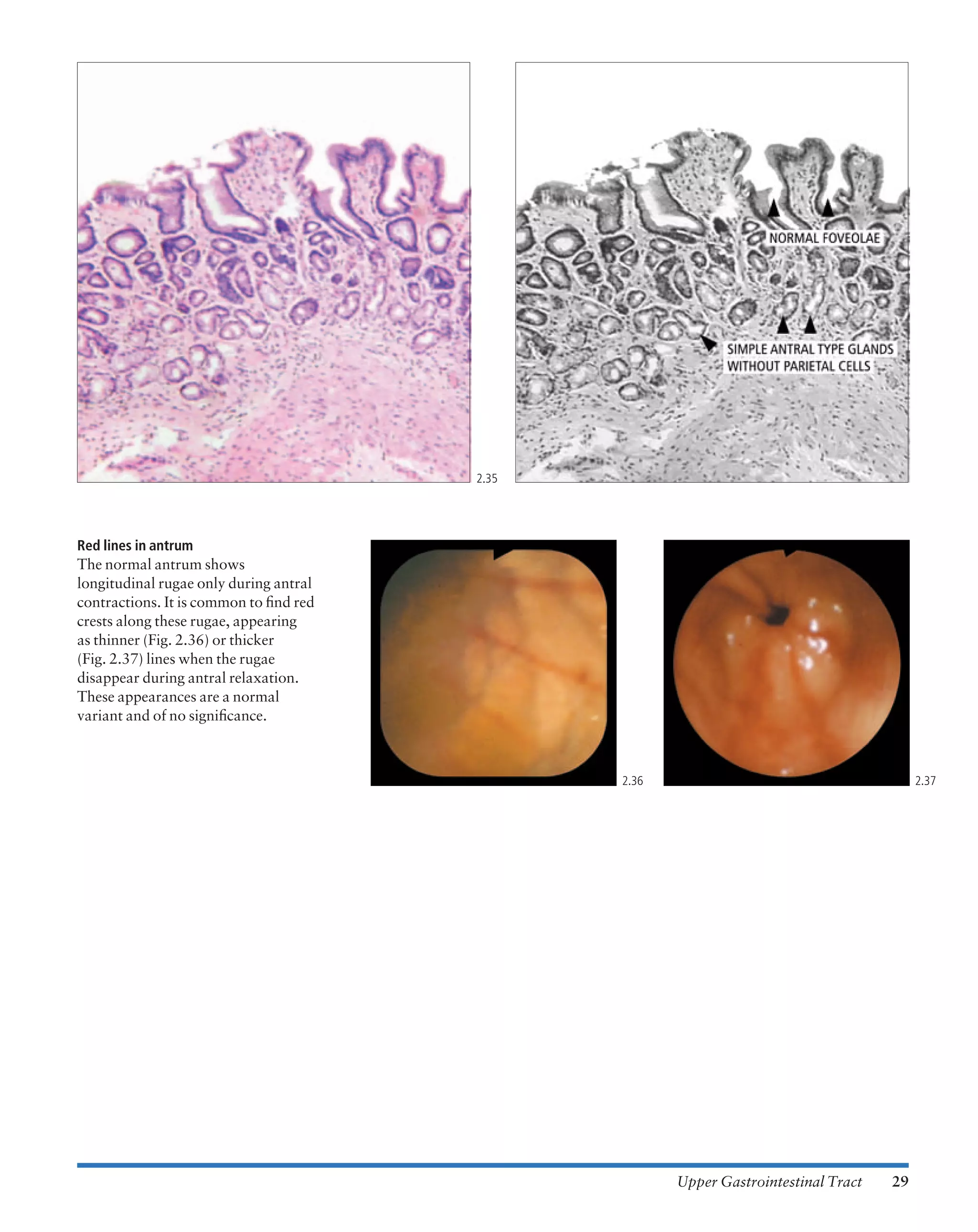 Atlas of gastrointestinal endoscopy and related pathology (blackwell ...