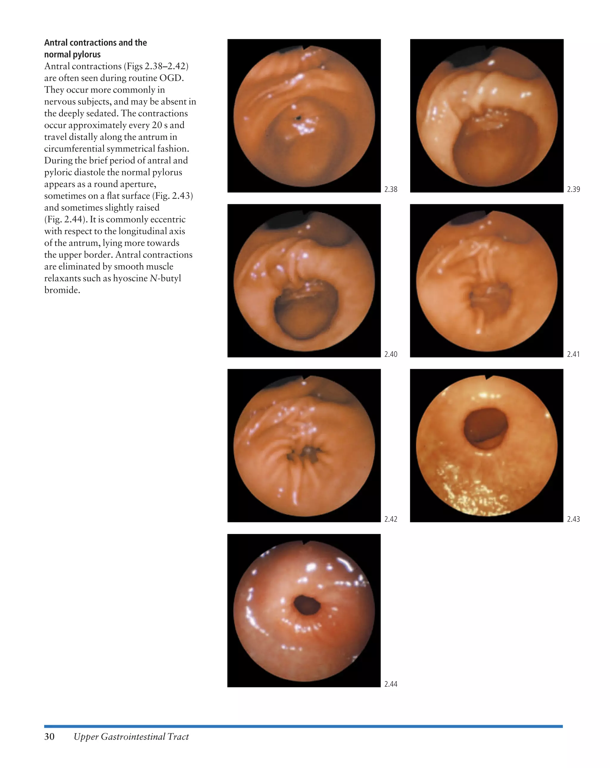 Atlas of gastrointestinal endoscopy and related pathology (blackwell ...