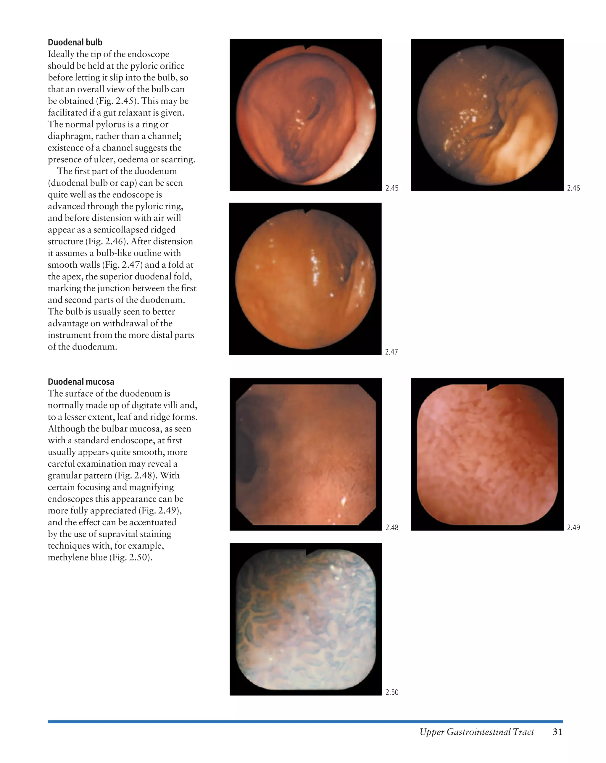Atlas of gastrointestinal endoscopy and related pathology (blackwell ...