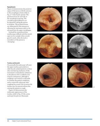 Atlas of gastrointestinal endoscopy and related pathology (blackwell ...