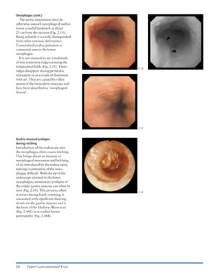 Atlas of gastrointestinal endoscopy and related pathology (blackwell ...
