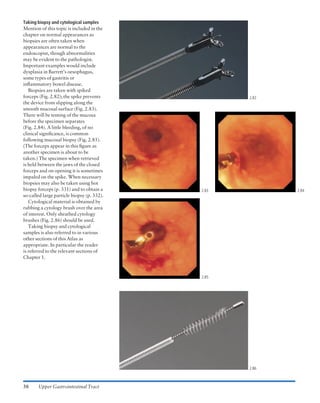 Atlas of gastrointestinal endoscopy and related pathology (blackwell ...
