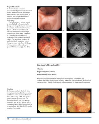 Atlas of gastrointestinal endoscopy and related pathology (blackwell ...