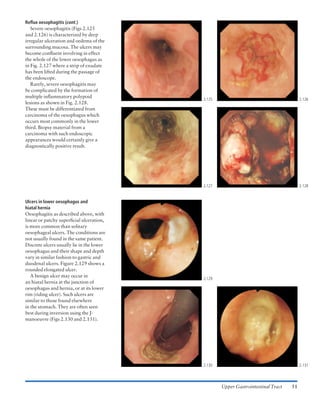 Atlas of gastrointestinal endoscopy and related pathology (blackwell ...
