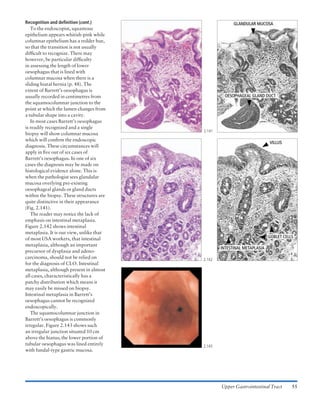 Atlas of gastrointestinal endoscopy and related pathology (blackwell ...