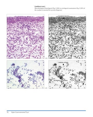 Atlas of gastrointestinal endoscopy and related pathology (blackwell ...