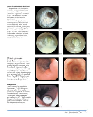 Atlas of gastrointestinal endoscopy and related pathology (blackwell ...