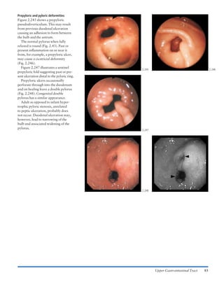 Atlas of gastrointestinal endoscopy and related pathology (blackwell ...