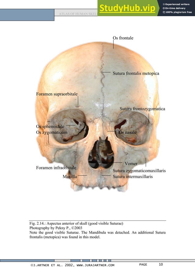 ATLAS OF HUMAN SKELETAL ANATOMY ATLAS OF HUMAN SKELETAL ANATOMY Cranium ...