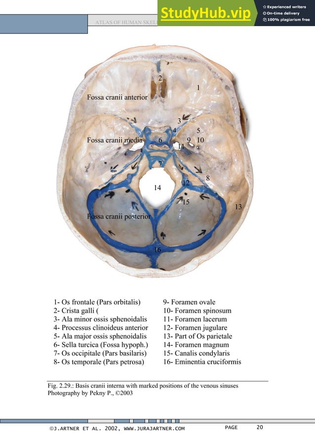 ATLAS OF HUMAN SKELETAL ANATOMY ATLAS OF HUMAN SKELETAL ANATOMY Cranium ...