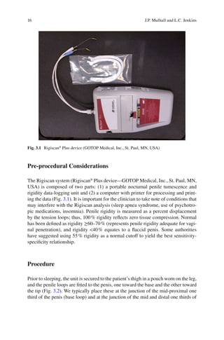 Atlas of offi ce based andrology procedures | PDF