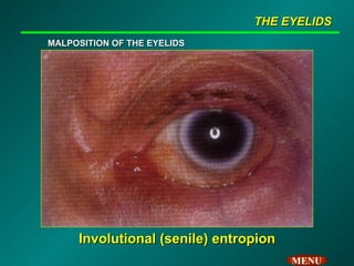 Atlas of opthalmology_tanta_university | PPT