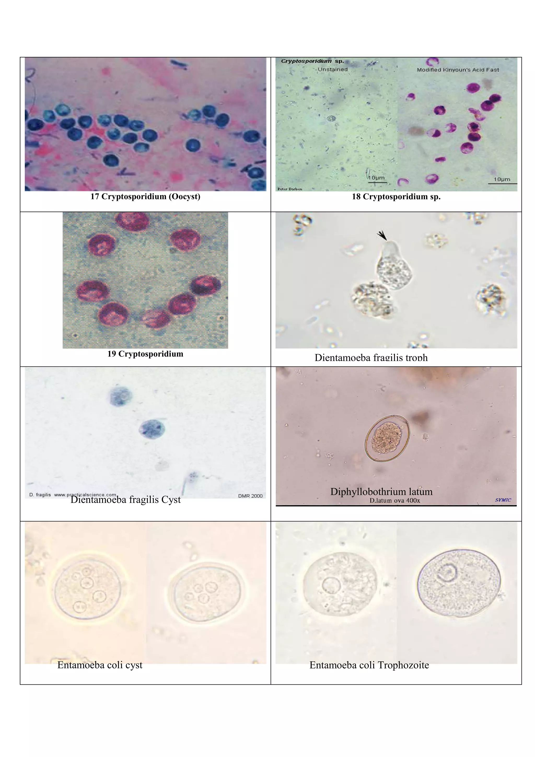 Dientamoeba Fragilis Troph
