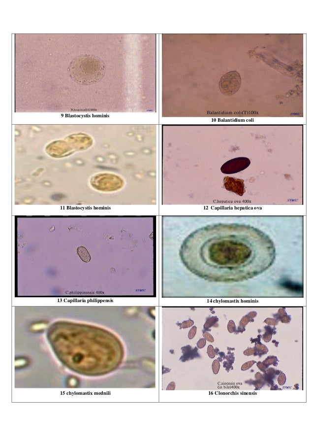 Atlas of parasitology