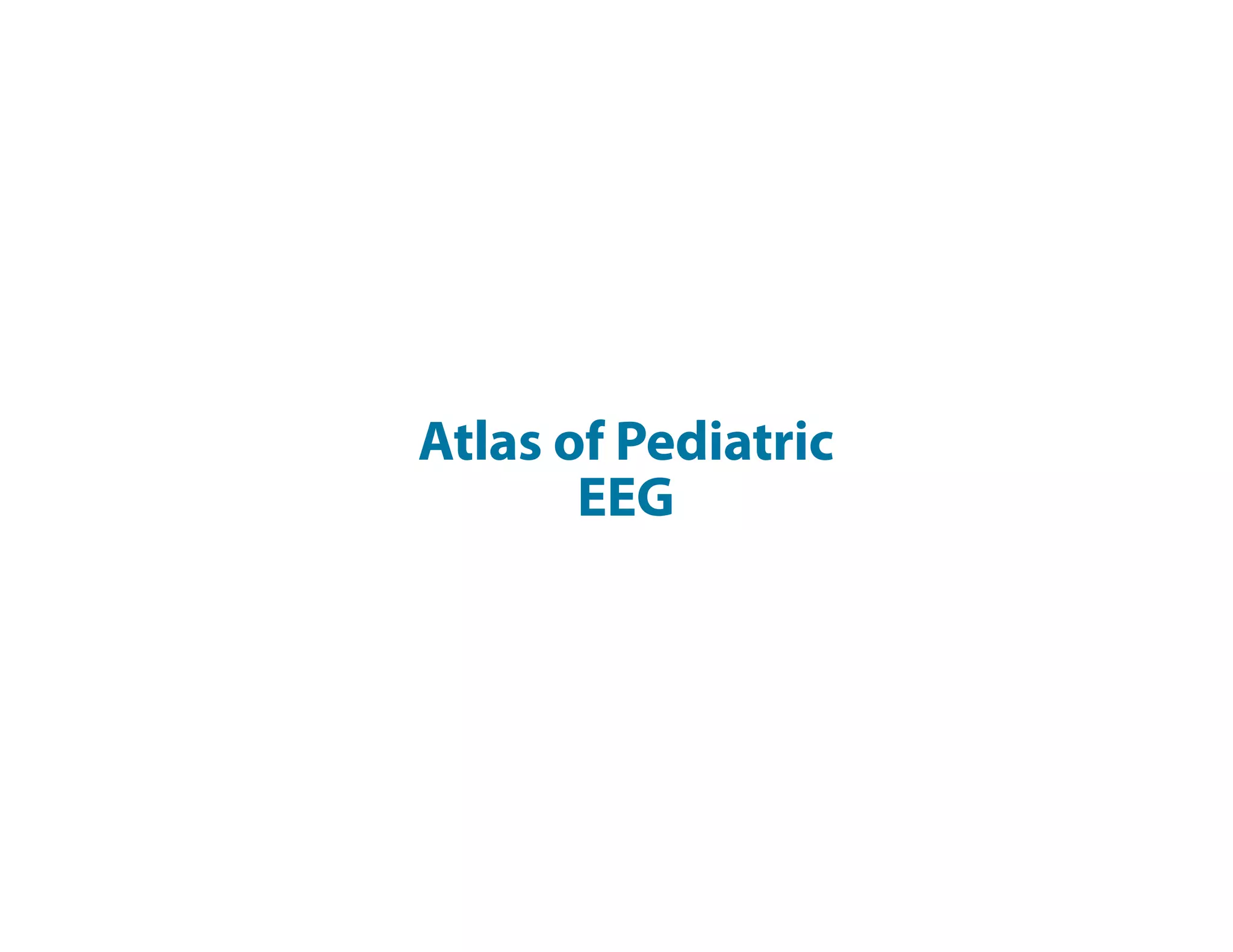 Atlas of Pediatric EEG.pdf
