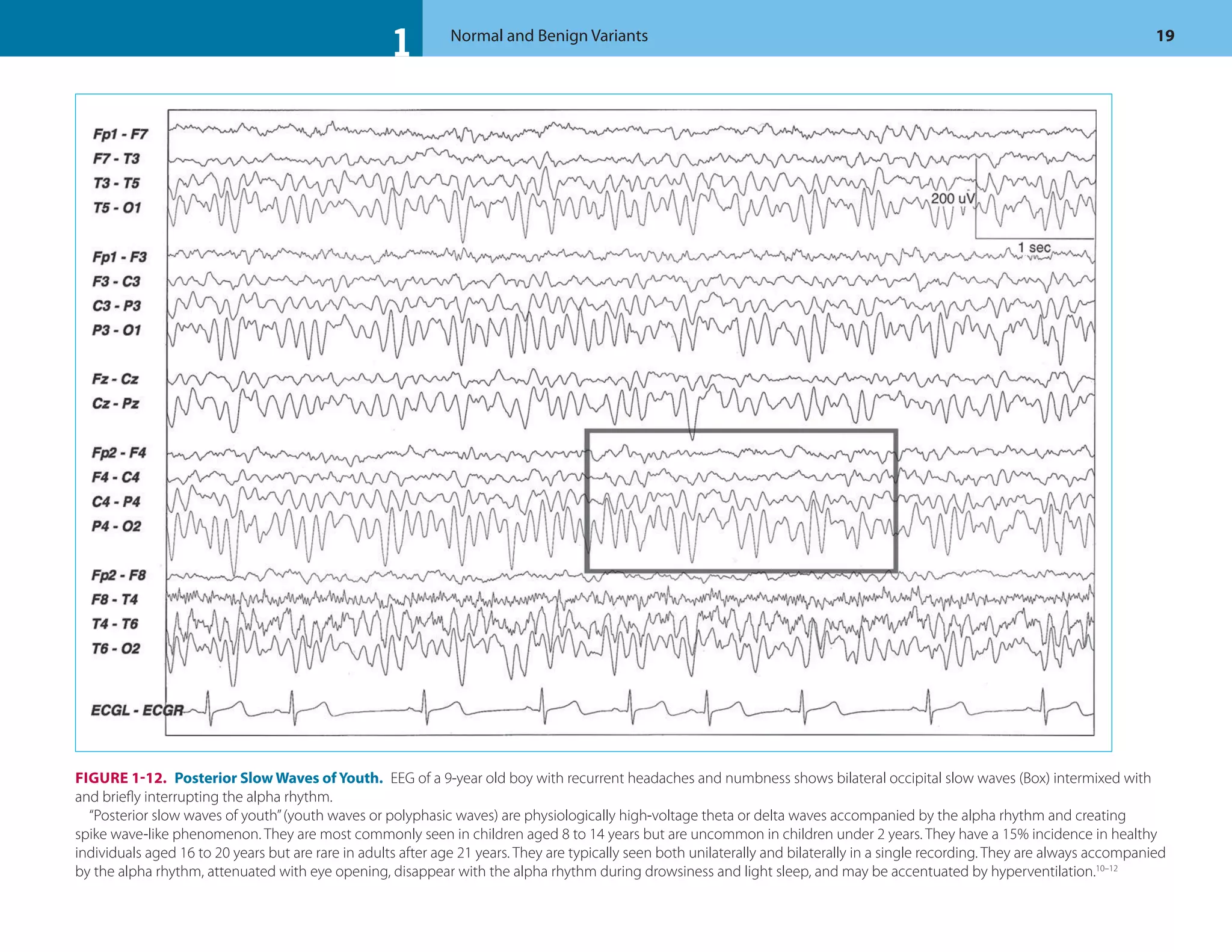 Atlas of Pediatric EEG.pdf