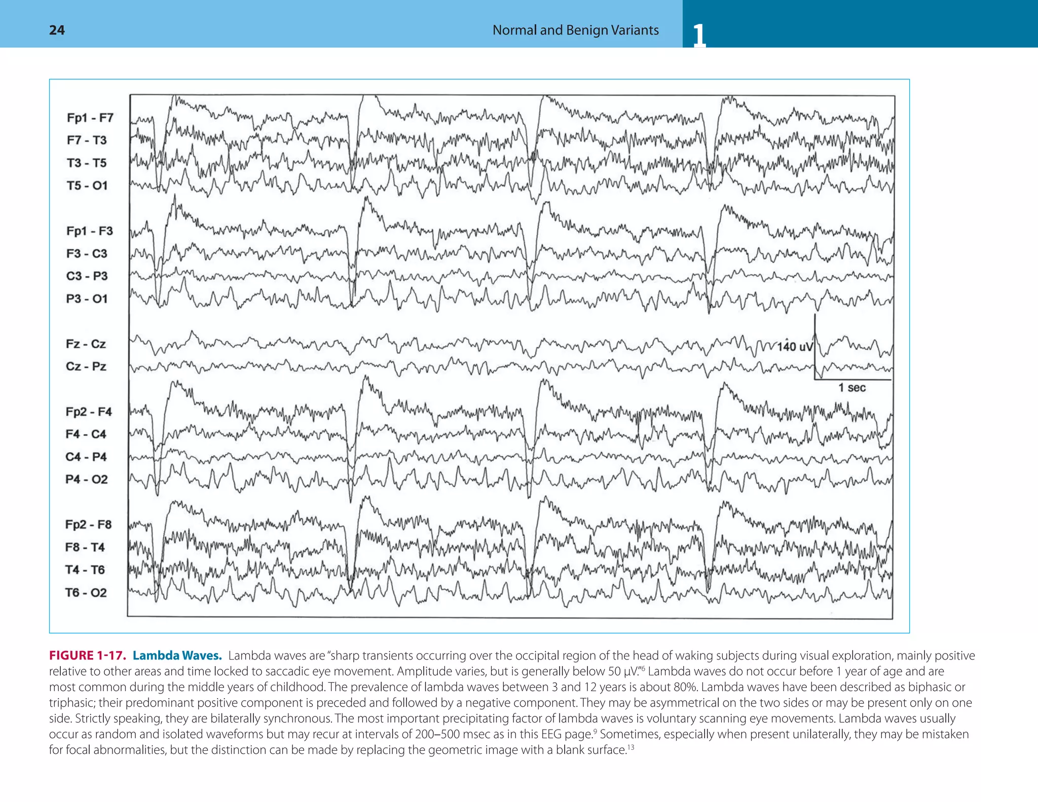 Atlas of Pediatric EEG.pdf