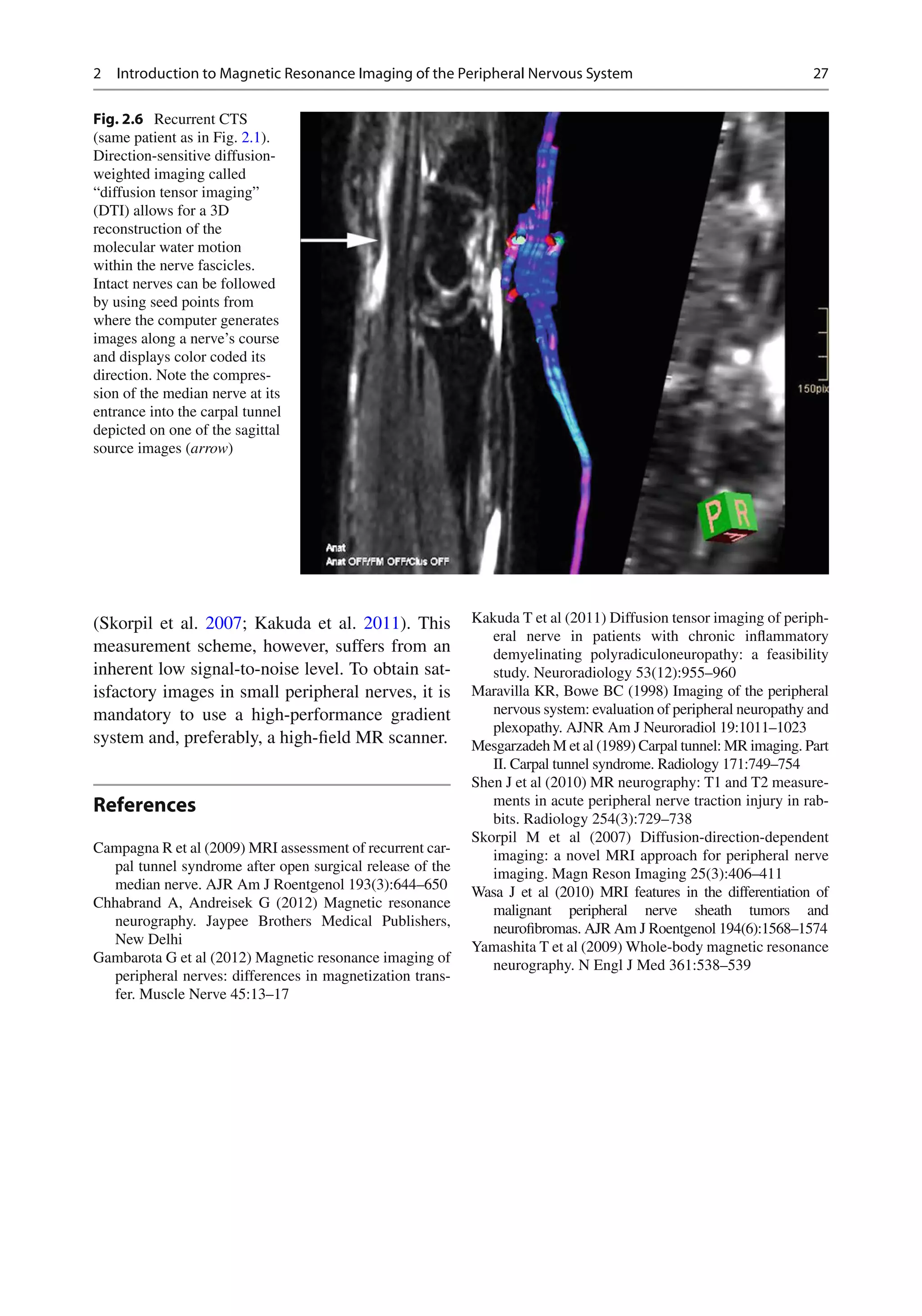 Atlas of peripheral nerve ultrasound | PDF