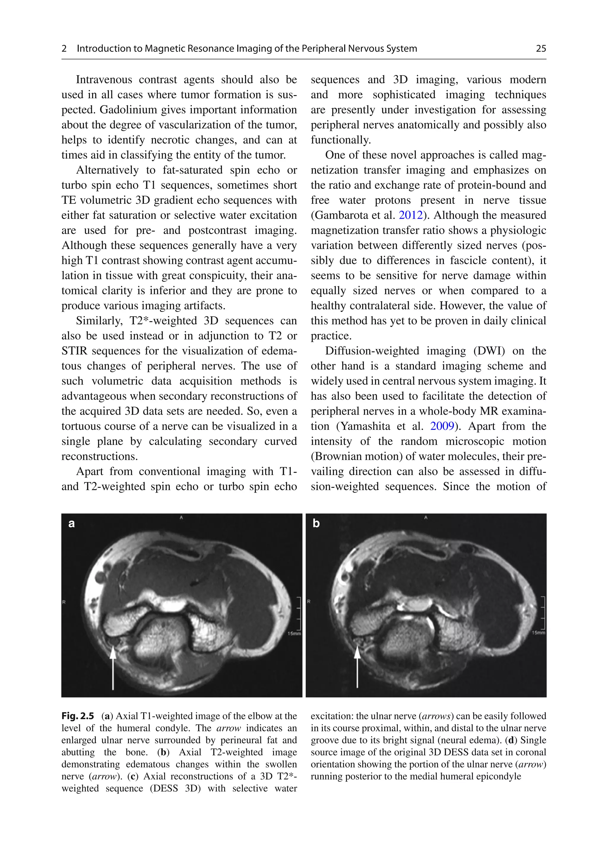 Atlas of peripheral nerve ultrasound | PDF