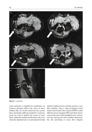Atlas of peripheral nerve ultrasound | PDF