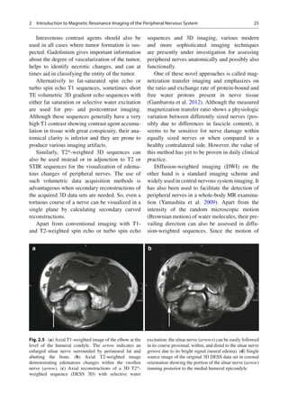 Atlas of peripheral nerve ultrasound | PDF