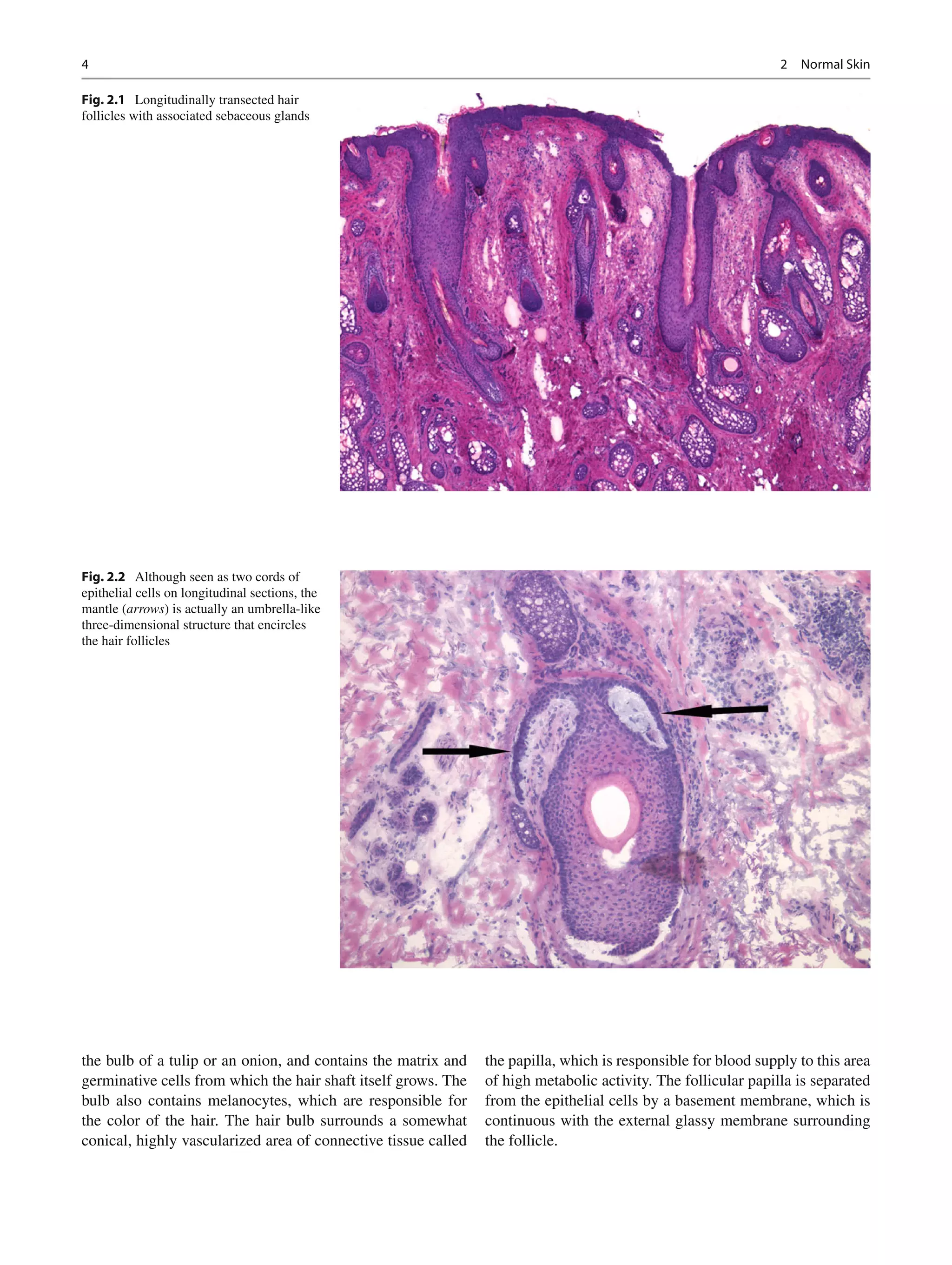 Atlas of practical mohs histopathology | PDF