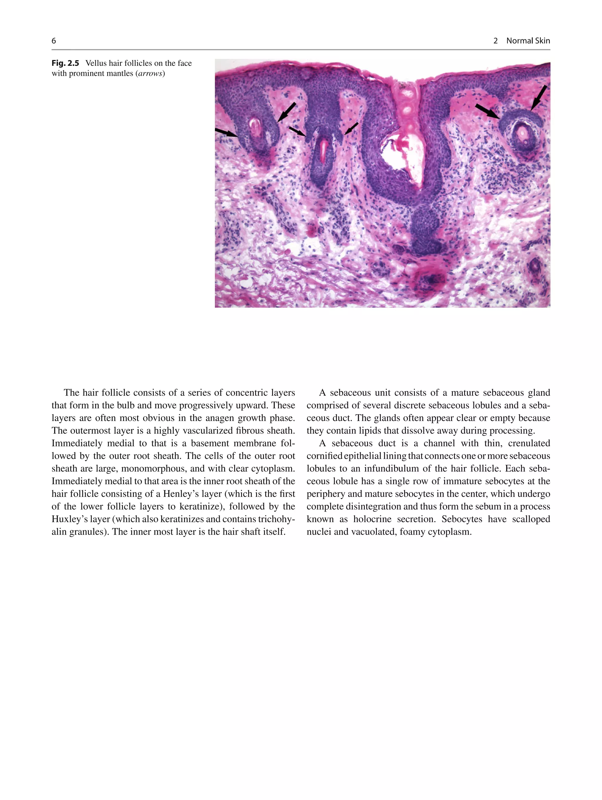 Atlas of practical mohs histopathology | PDF